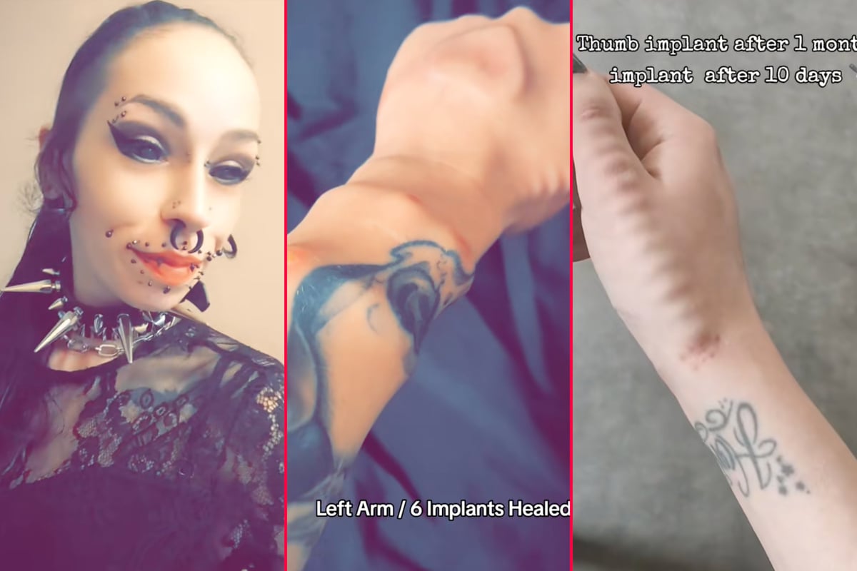 Extreme tattoo fanatic embeds silicon beneath her skin in radical body ...
