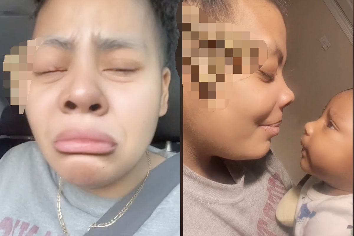 Woman s Story Goes Viral As She Overcomes Growth On Her Face Archyworldys Woman s Story Goes Viral As She Overcomes Growth On Her Face Archyworldys