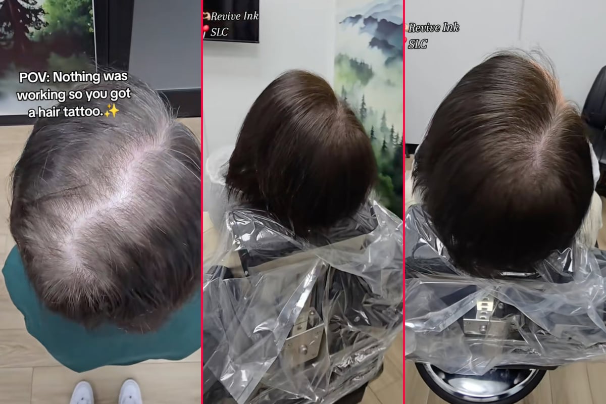 Woman gets "hair tattoo" to cover up hair loss, and the results are ...