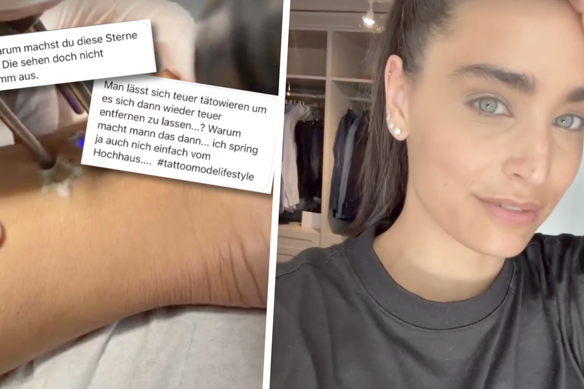 Amira Pocher spricht nach Tattoo-Entfernung ernstes Wörtchen mit ihren Fans