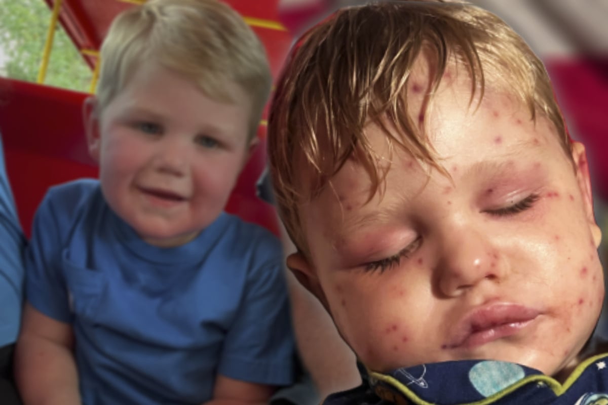 Schockierende Attacke: Zwei Jahre alter Beckham Reed kämpft nach ...