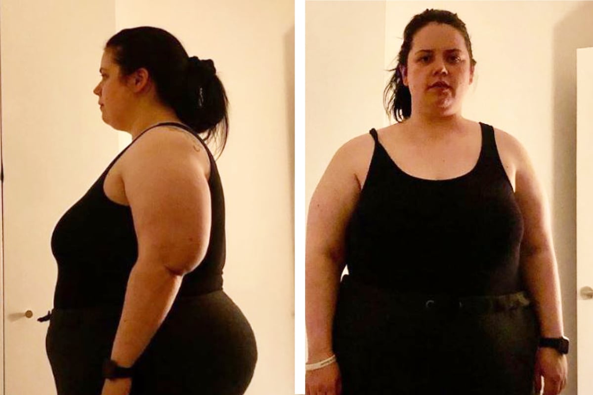 147-Kilo-Frau ist heute mega schlank: Doch was sie dazu zu sagen hat, ist bitter