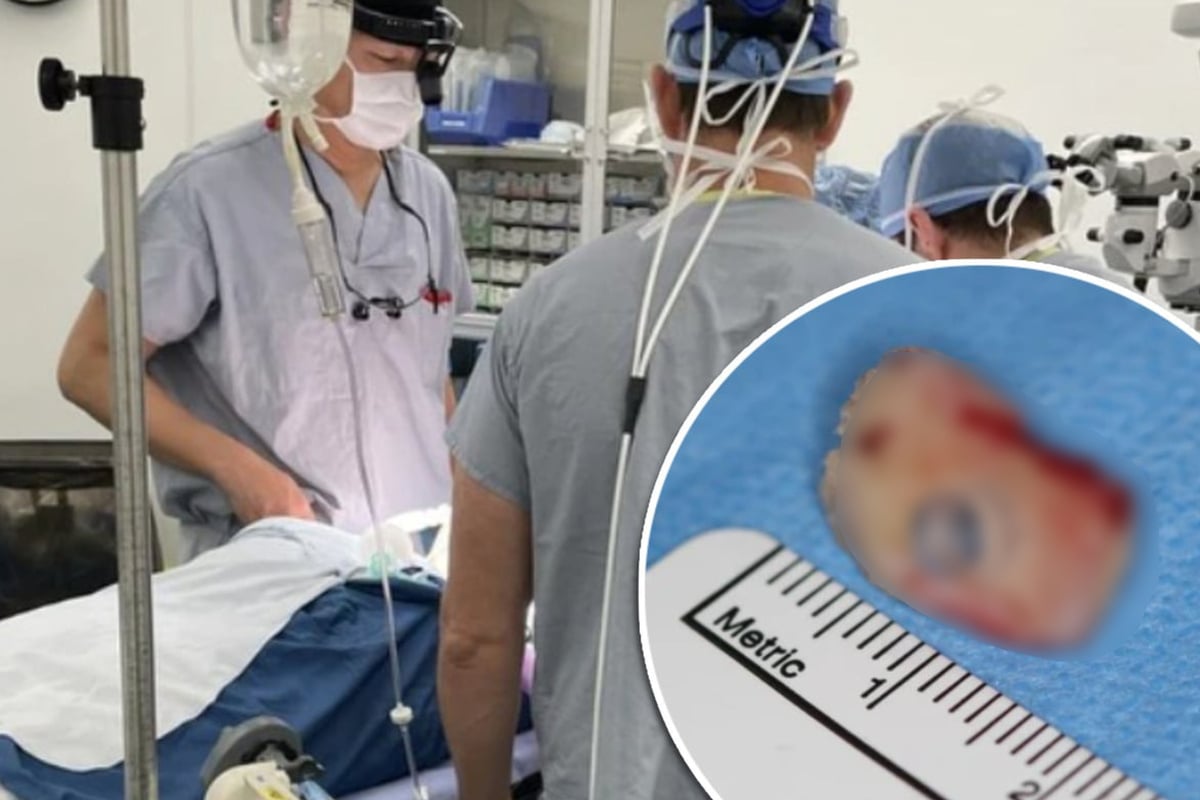 Blind man has tooth operated on in his eye: "Sounds crazy and like ...