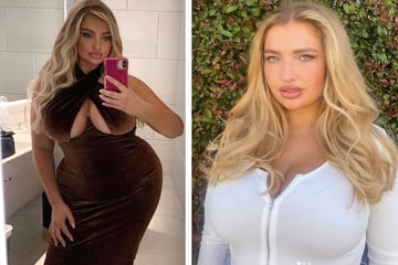 Tumor-Schock für Sarina Nowak: Curvy Model musste am Kopf operiert werden