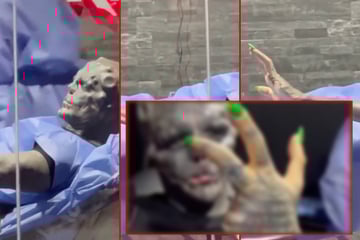 Black Alien tattoo addict shares finger amputation video and teases ...