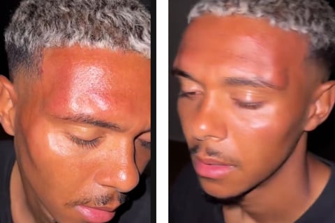 FCN-Spieler Niklas-Wilson Sommer von eigenen Fans angegriffen: Schock ...