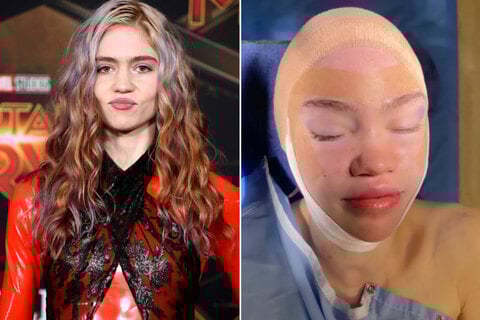 Grimes shares post-surgery pic and big news: "I did smthn crazy!"