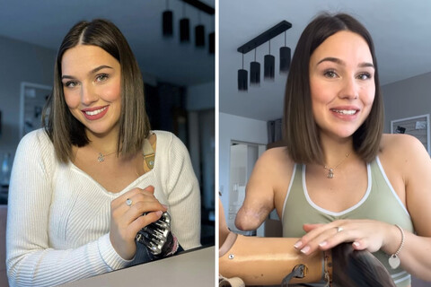 Prothesen-Beauty Gina Rühl witzelt über fehlenden Arm: "Bezahle im ...