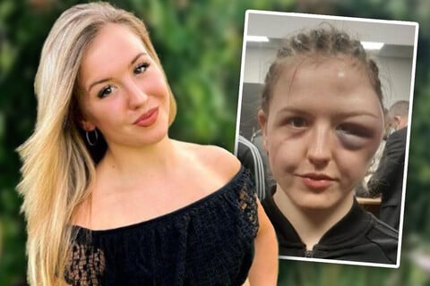 Horror-Schwellung! Hübsche Boxerin Cheyenne Hanson übel zugerichtet