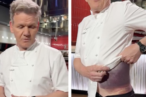 Celebrity chef Gordon Ramsay shows shocking photos of bike accident ...