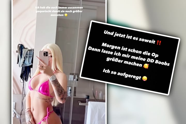 Katja Krasavice nimmt Fans hautnah bei neuer Schönheits-OP mit: Es wird größer!
