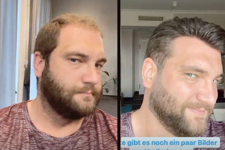 Kaum wiederzuerkennen! HadeB-Philipp sieht plötzlich ganz anders aus