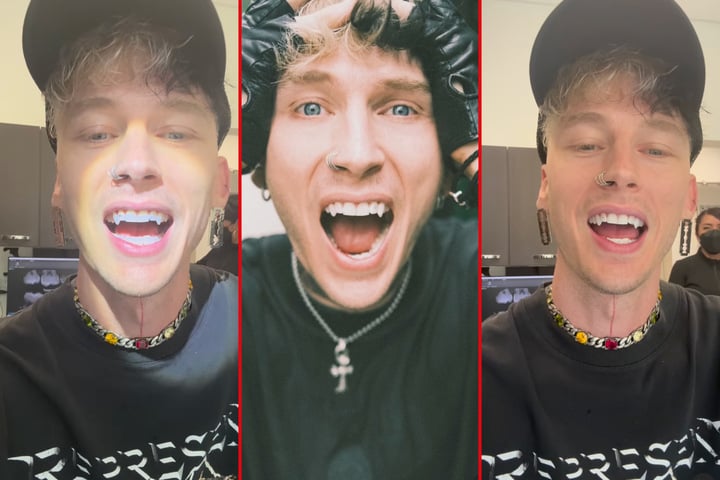 Machine Gun Kelly gets vampire fangs after radical blackout tattoo journey