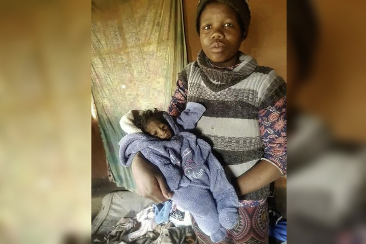 South African baby girl born with incredibly rare condition