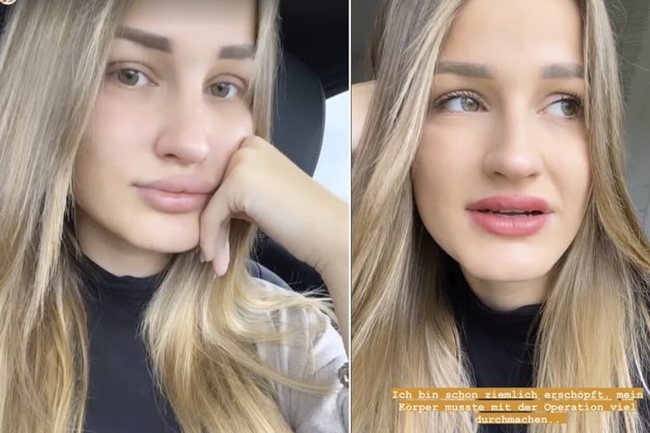 Neele Bronst: Ex-GNTM-Model fand Brust-OP "dringend nötig!"