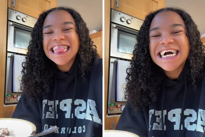 Olympia-Sportlerin Mica Moore (29) nuckelt immer noch am Daumen - so sehen ihre Zähne heute aus