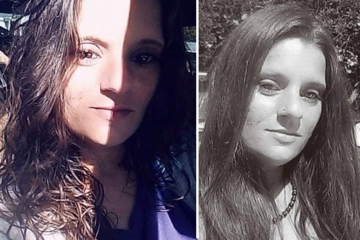 Nachdem drei Hunde sie angreifen, müssen Kyleen Waltman die Arme ...