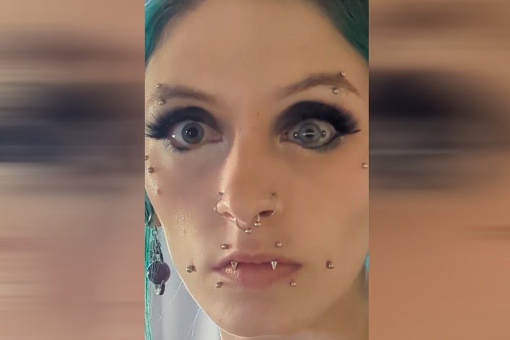 Instagram user shows off shocking eye piercing: "Stay Weird"