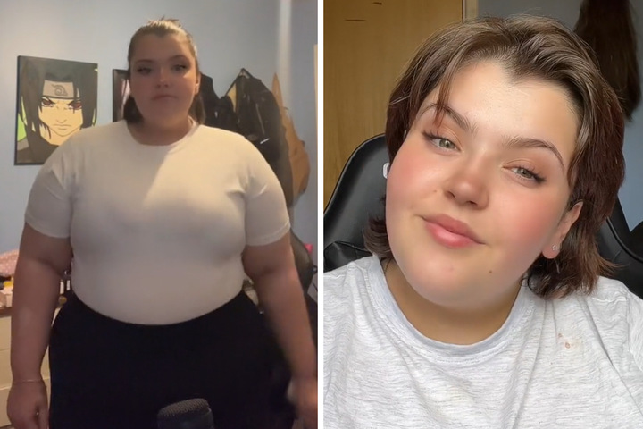 Septischer Schock: Junge Frau (†20) stirbt nach verpatzter Abnehm-OP!