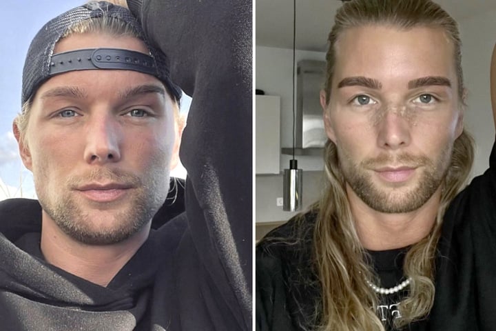 Prince Charming Kim beim Beauty-Doc? "Heute wird die Nase gemacht"