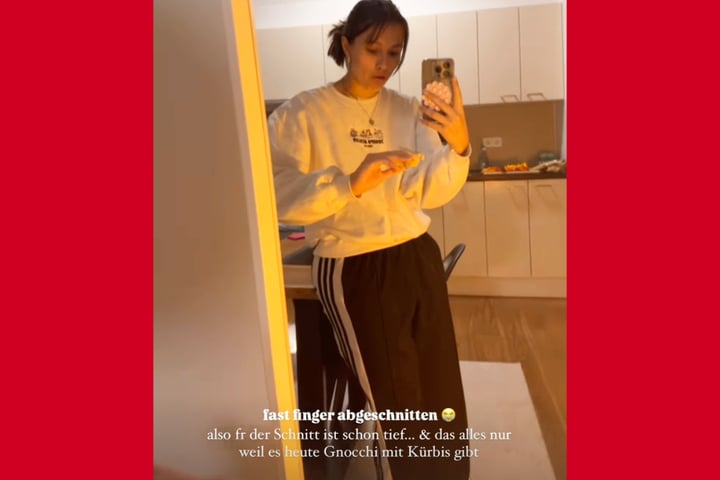 Influencerin Greta hat Unfall: "Fast Finger abgeschnitten"