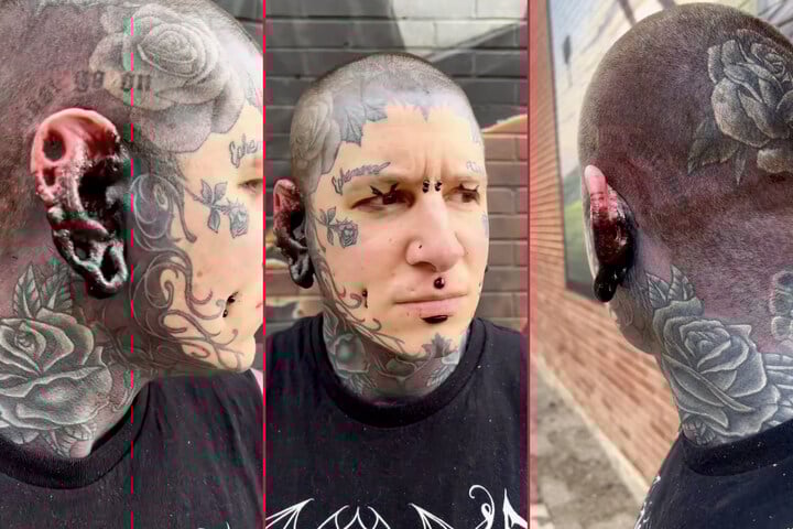 Extreme ink addict Remy tattoos ears black and slams haters in raging post