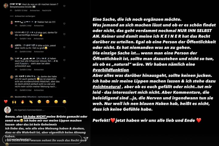 GNTM-Model Larissa zeigt heißes De­kolle­té und muss Fans zurechtweisen